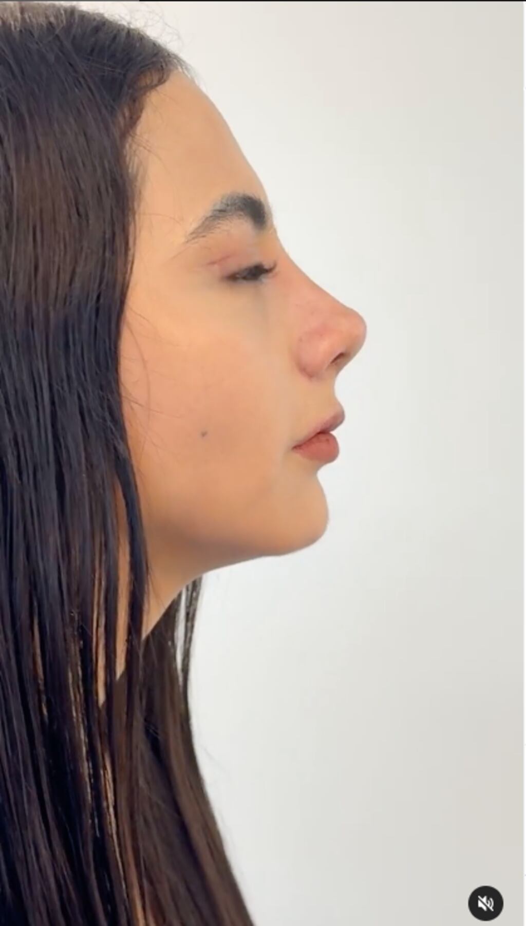 La reacción de Tami Rivera cuando vio el resultado de su cirugía – Metro Ecuador